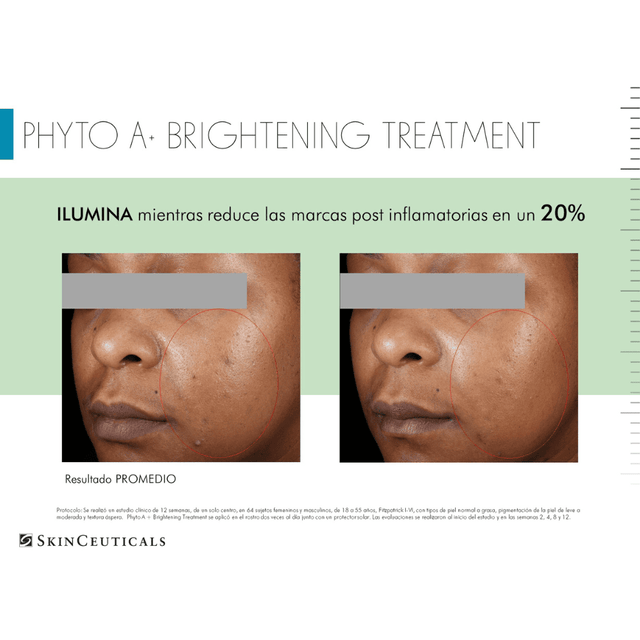 SkinCeuticals Gel Hidratante Corrector Phyto A+ Brightening Treatment ...